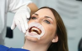 OPTRAGATE 2 SMALL REFILL IVOCLAR